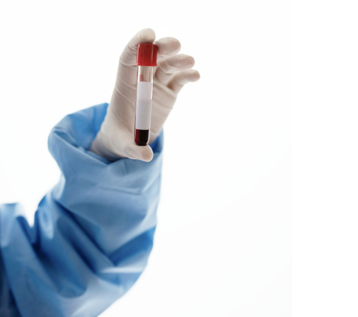 High ESR Levels Explained: Causes Of High ESR & What It Means